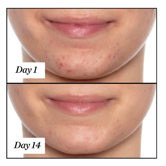 Sunday Riley | Skincare | Sunday Riley Ufo Ultra Clarifying Acne ...